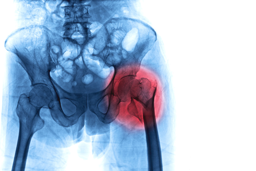 Upcoming Events | Orthopaedic Research UK